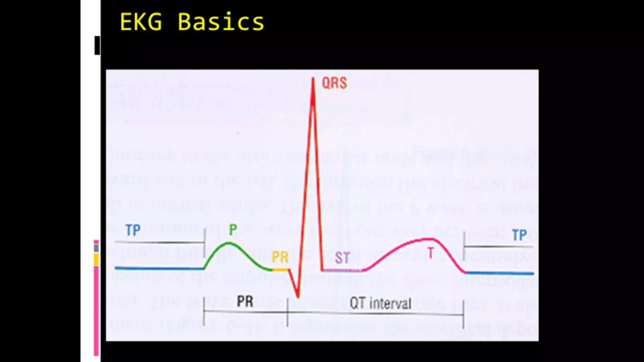 REVISI Materi 1 ECG Club - Dasar EKG, Sinus, Rate.pptx