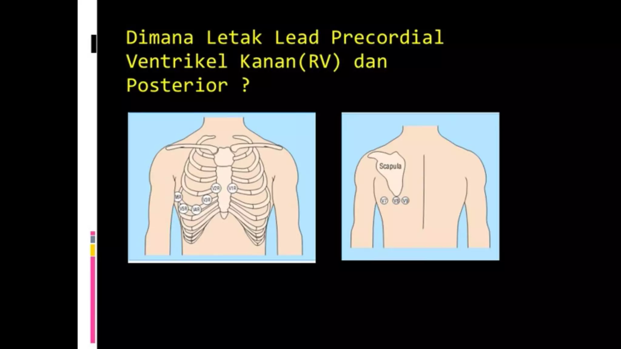 REVISI Materi 1 ECG Club - Dasar EKG, Sinus, Rate.pptx