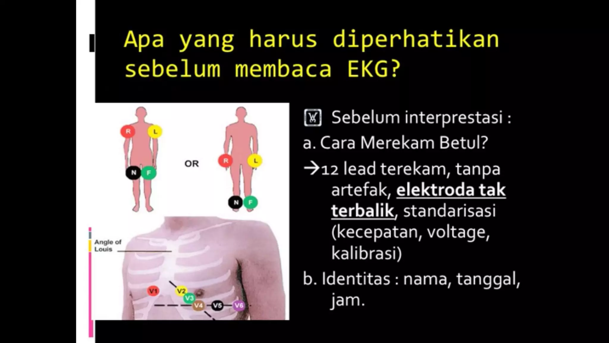 REVISI Materi 1 ECG Club - Dasar EKG, Sinus, Rate.pptx