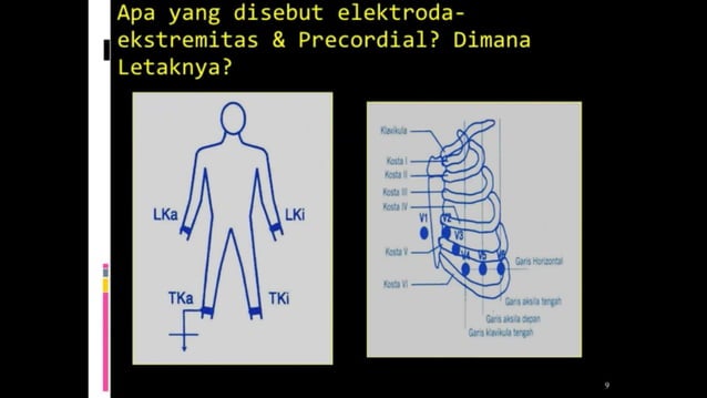 REVISI Materi 1 ECG Club - Dasar EKG, Sinus, Rate.pptx