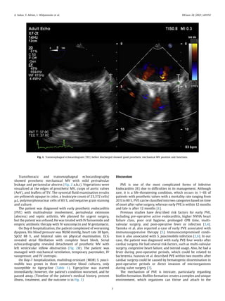 Sphingomonas paucimobilis, reporte de caso | PDF