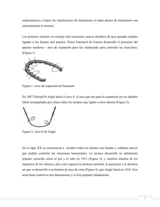 Revisión de las diferentes técnicas ortodonticas | PDF