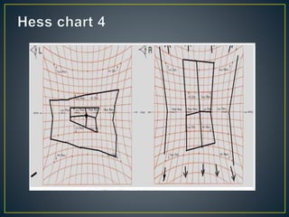 Revision about Hess Chart | PPTX