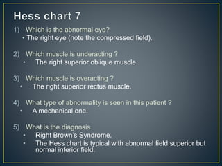 Revision about Hess Chart | PPTX
