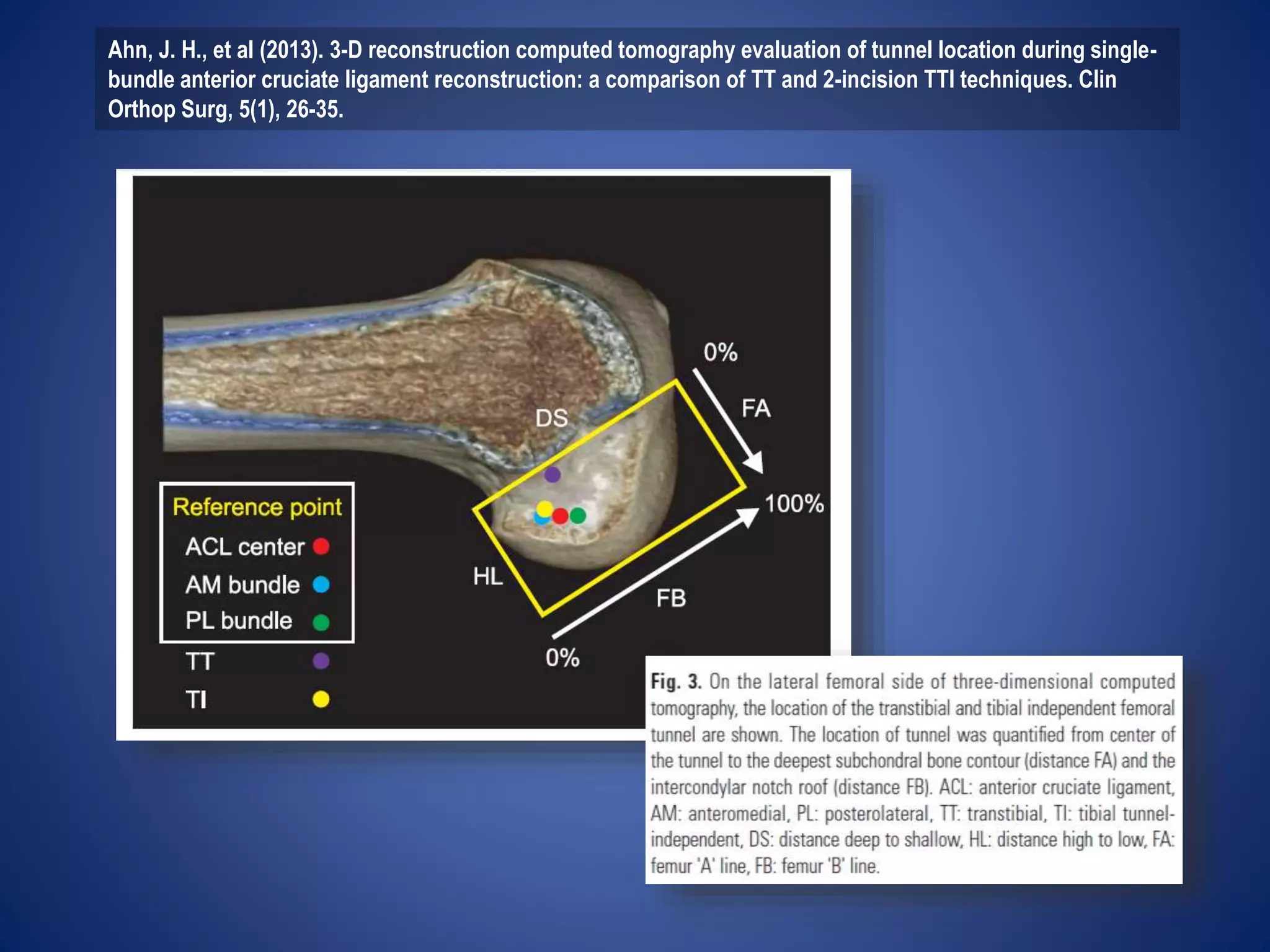 Revision ACL Reconstruction - A Case Presentation and Literature Review ...