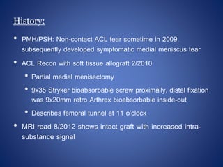Revision ACL Reconstruction - A Case Presentation and Literature Review ...