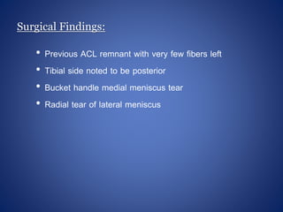Revision ACL Reconstruction - A Case Presentation and Literature Review ...