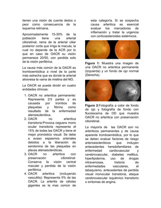Revision de oclusiones arteriales | DOCX