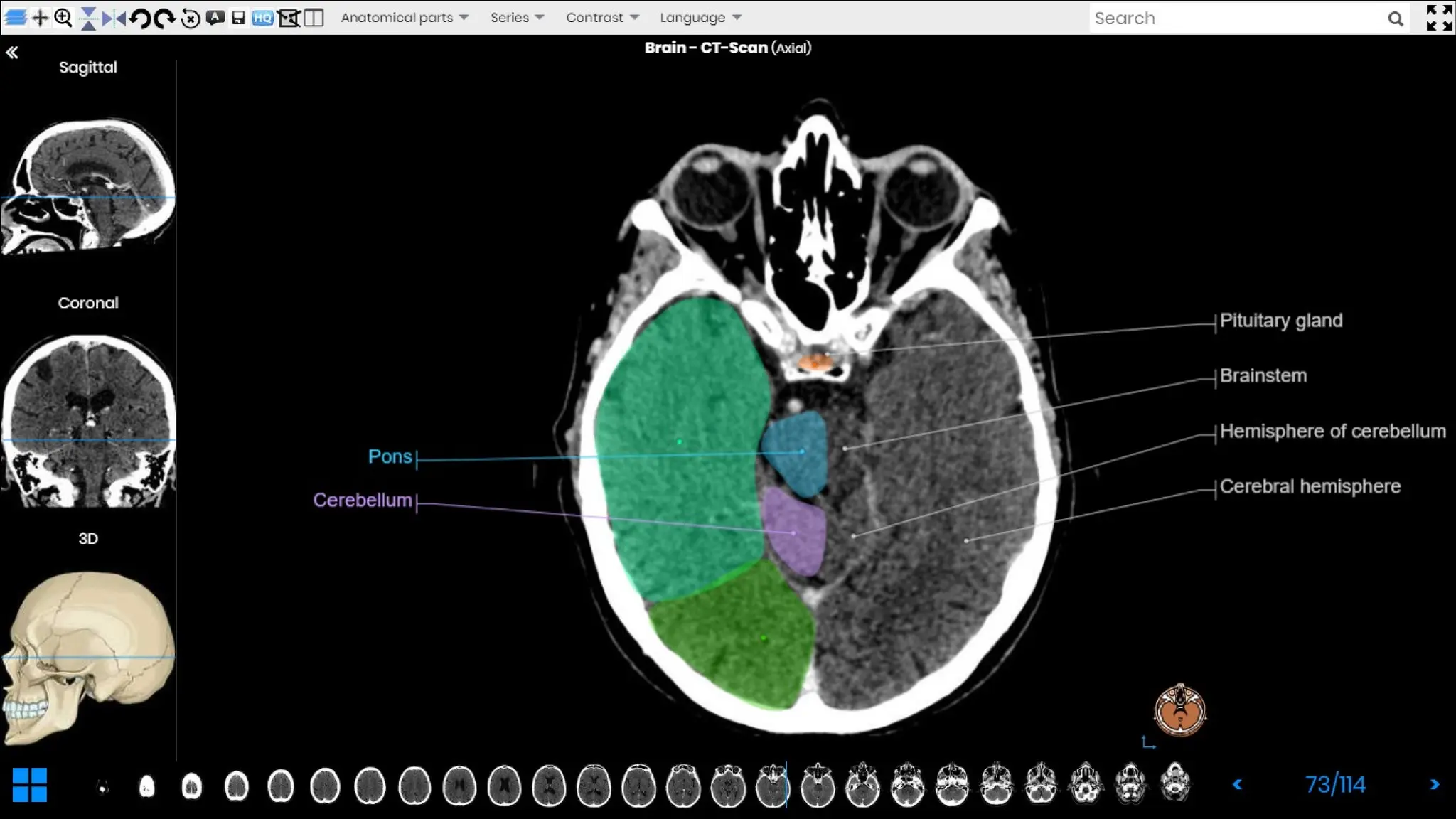 Revision for brain cross-sectional anatomy | PPTX