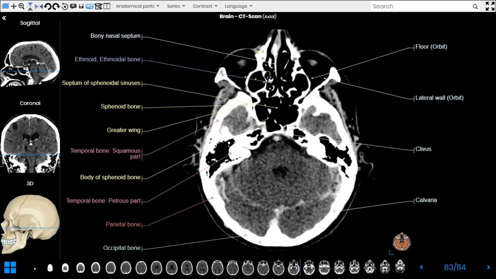 Revision for brain cross-sectional anatomy | PPTX
