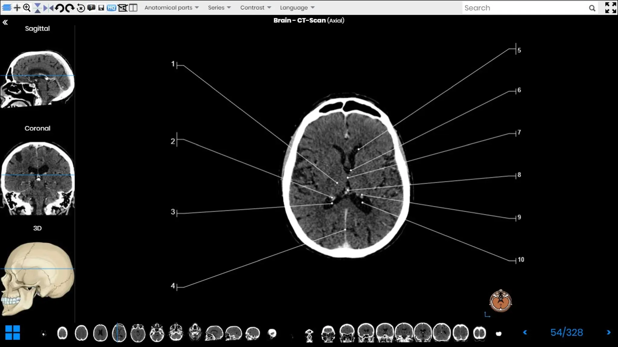 Revision for brain cross-sectional anatomy | PPTX