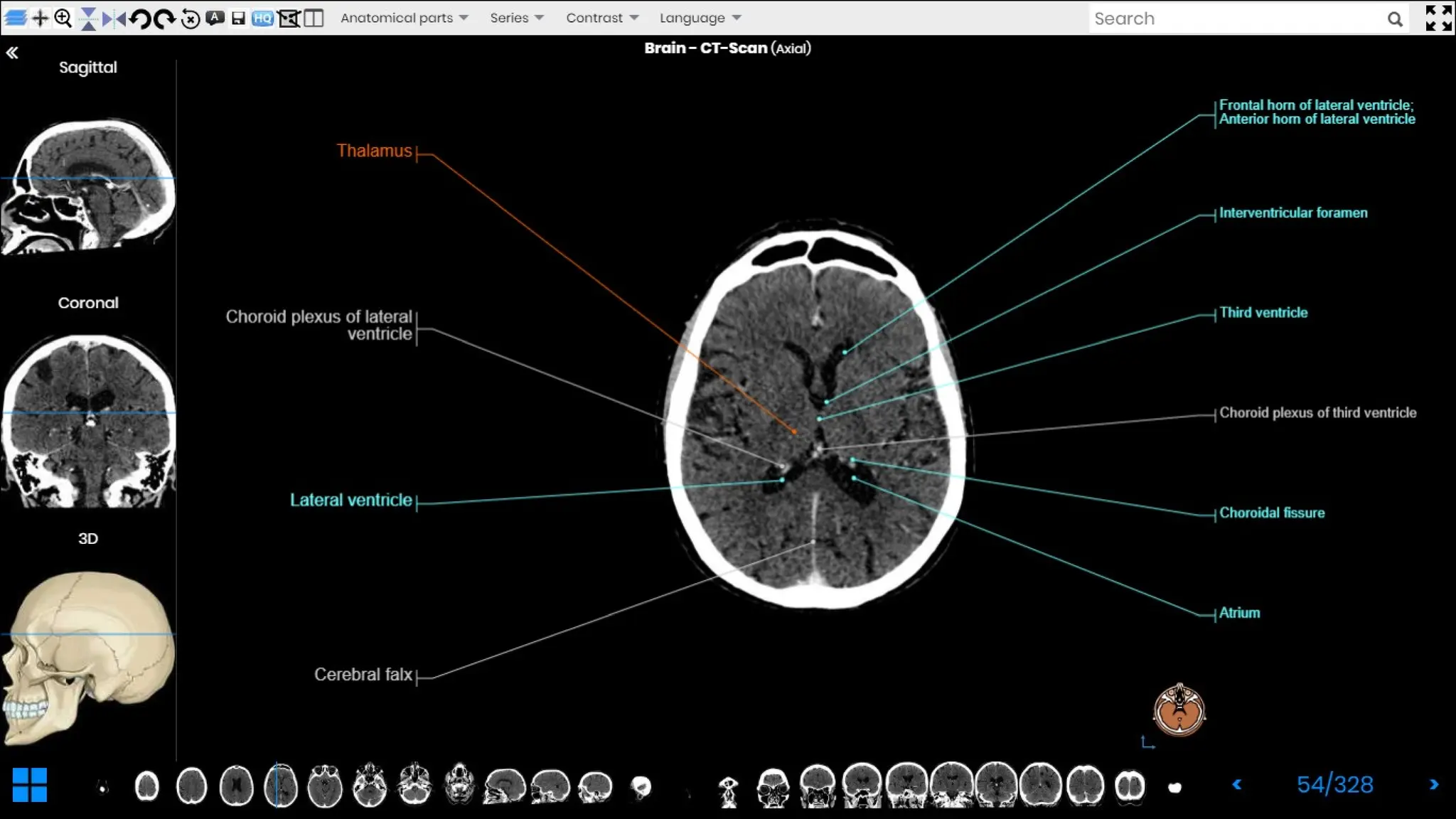 Revision for brain cross-sectional anatomy | PPTX