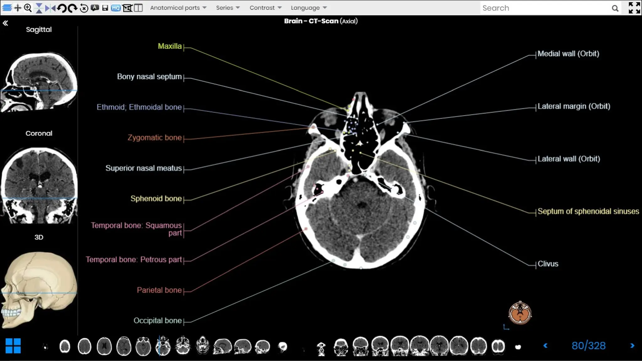 Revision for brain cross-sectional anatomy | PPTX