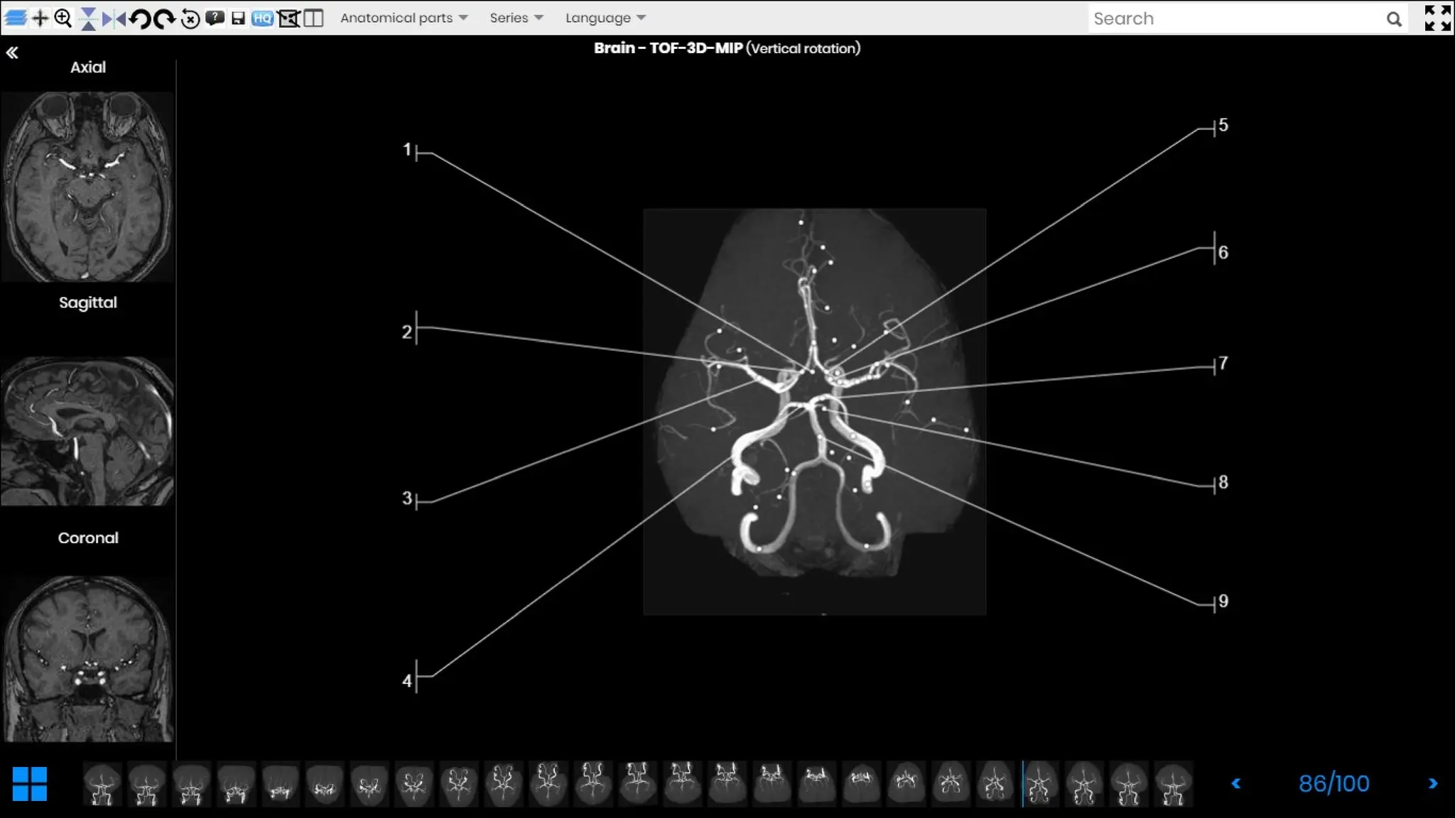 Revision for brain cross-sectional anatomy | PPTX