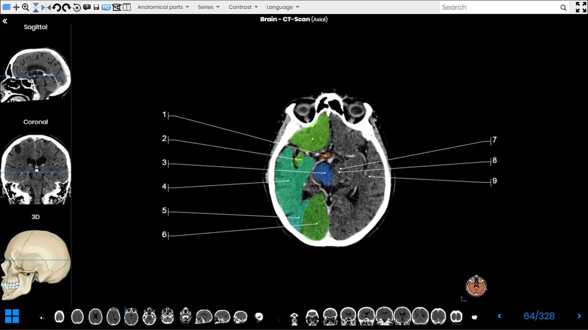 Revision for brain cross-sectional anatomy | PPTX