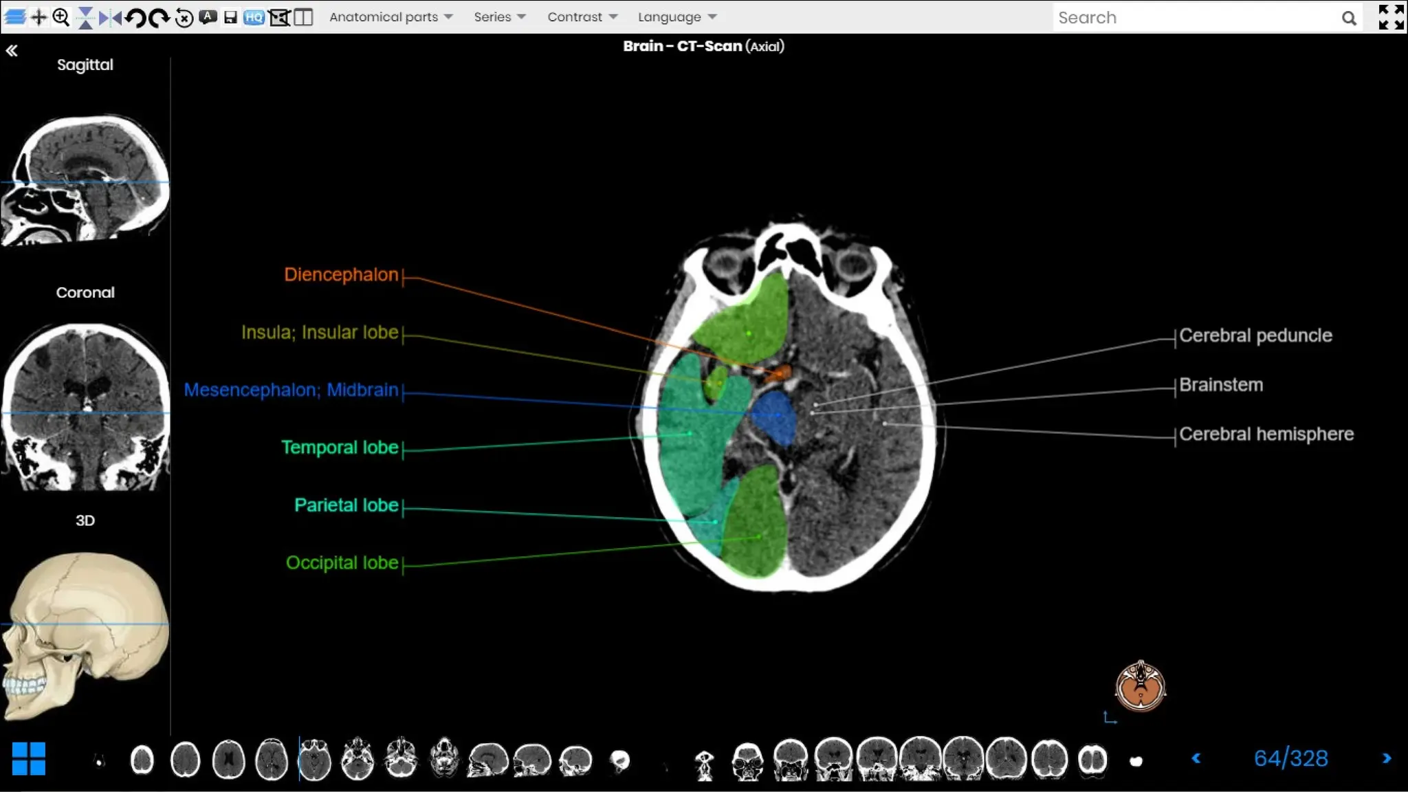 Revision for brain cross-sectional anatomy | PPTX