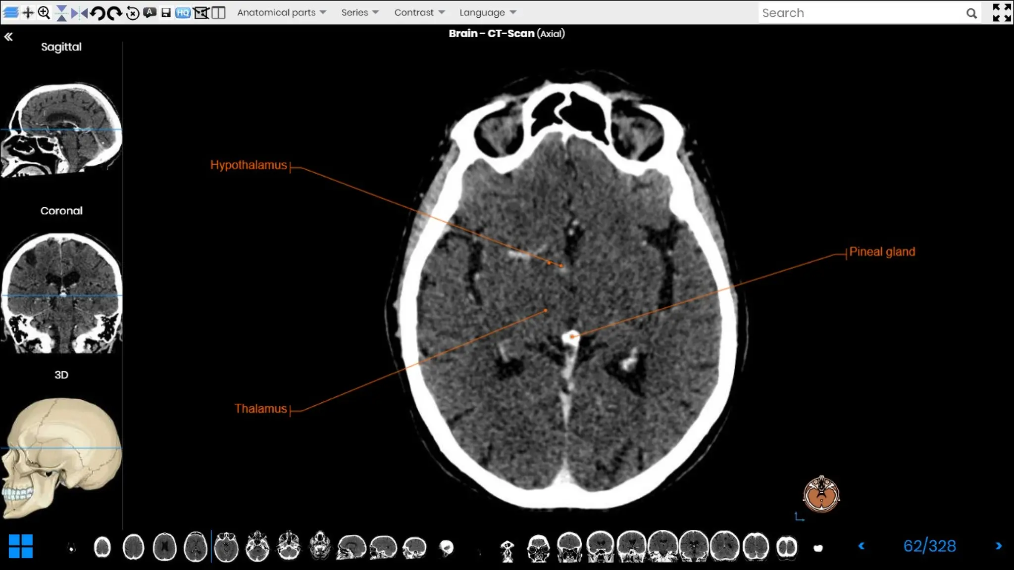 Revision for brain cross-sectional anatomy | PPTX