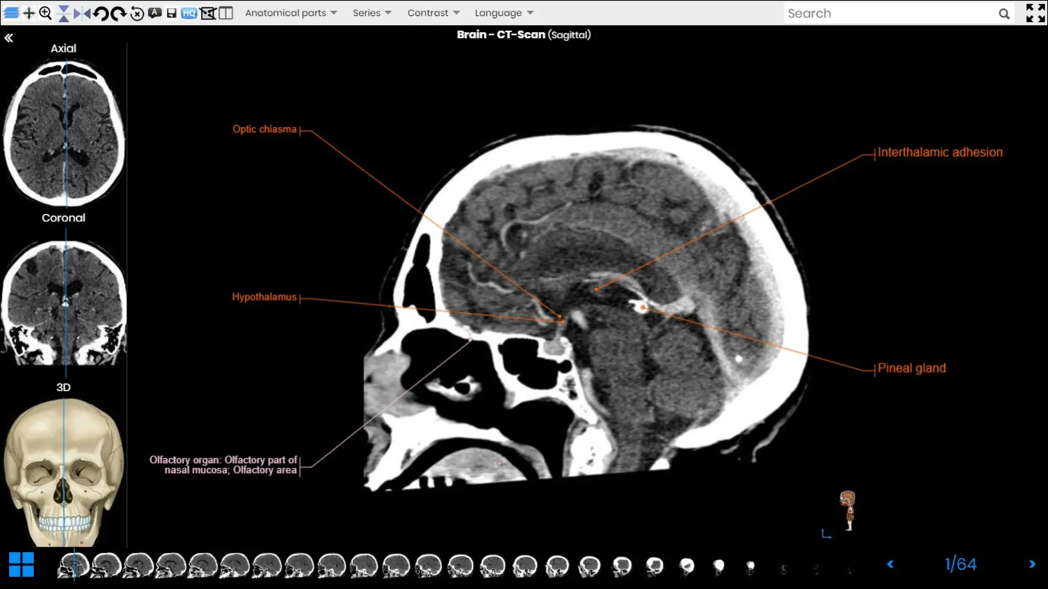 Revision for brain cross-sectional anatomy | PPTX