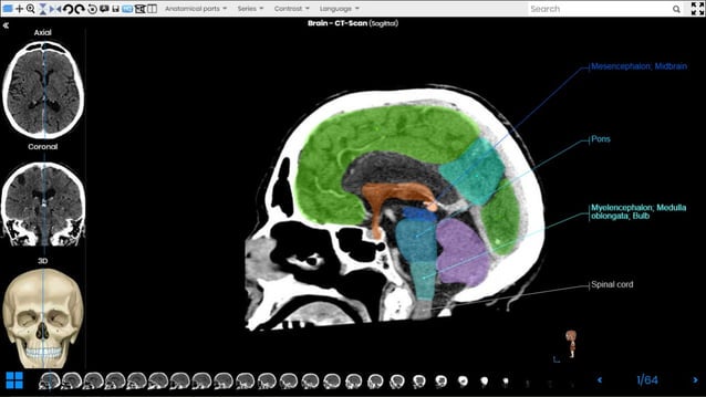 Revision for brain cross-sectional anatomy | PPTX