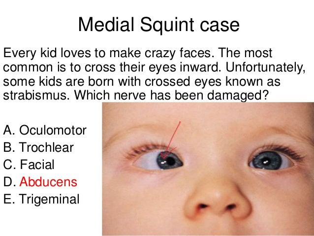 Revision of neuroanatomy