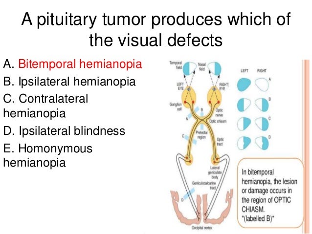 Revision of neuroanatomy