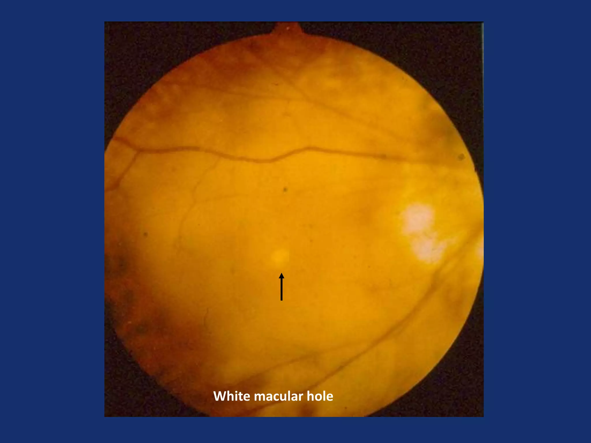 Revision of the Anatomy of the Posterior Aspect of the Eyeball - An ...