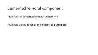 Revision Total Hip Replacement (THR): Surgical Principles, Techniques ...