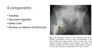 Revision Total Hip Replacement (THR): Surgical Principles, Techniques ...