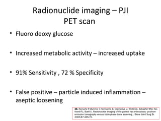 Revision thr indication, investigation & preparation | PPT