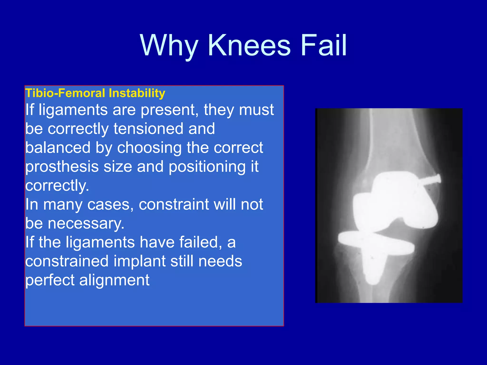 Revision TKR: Why Knee Fails Basic Surgical Principles Dr.Sandeep ...