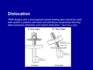 Revision TKR: Why Knee Fails Basic Surgical Principles Dr.Sandeep ...