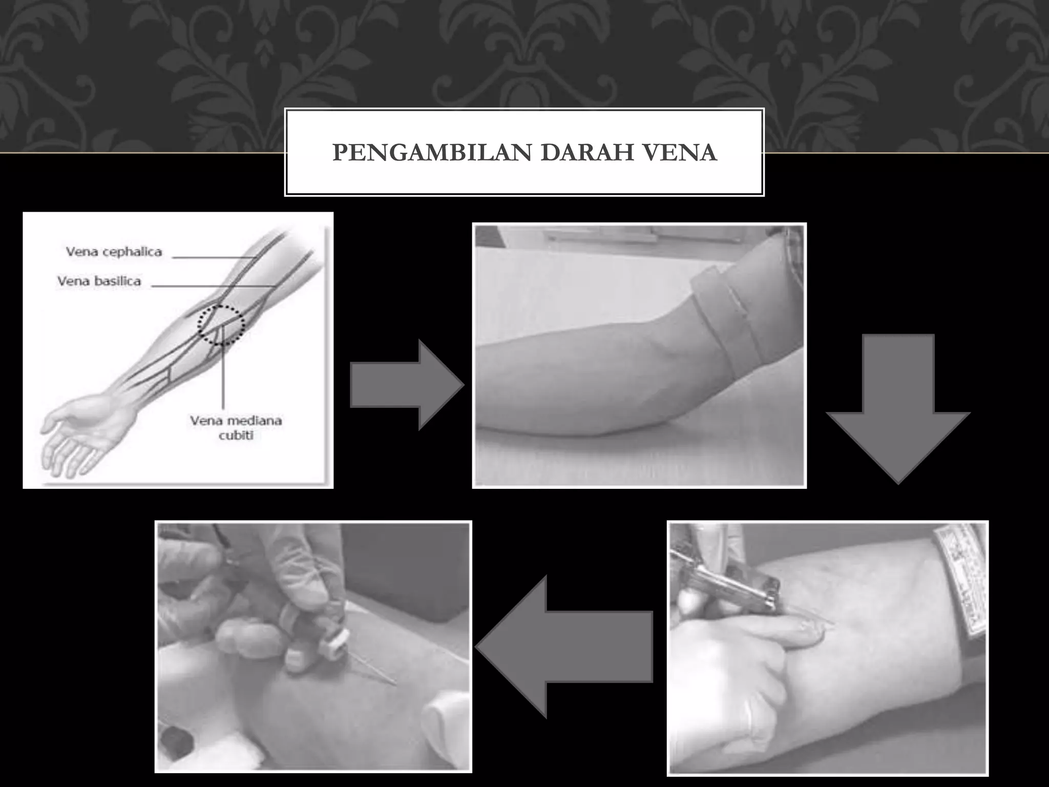 Plebotomi - teknik pengambilan darah vena | PPTX