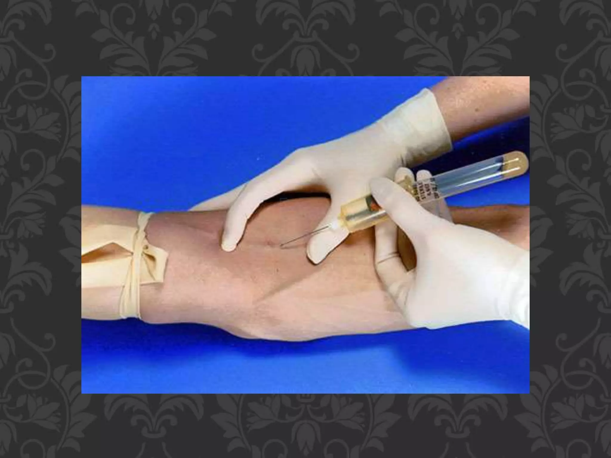 Plebotomi - teknik pengambilan darah vena | PPTX