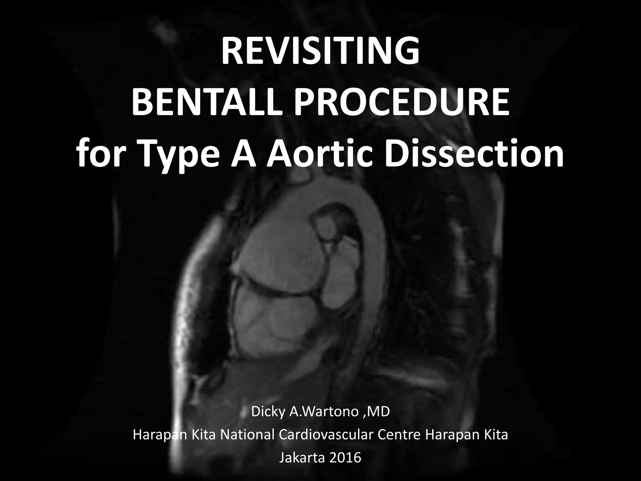 Revisiting bentall procedure | PPTX | First Aid | Injuries