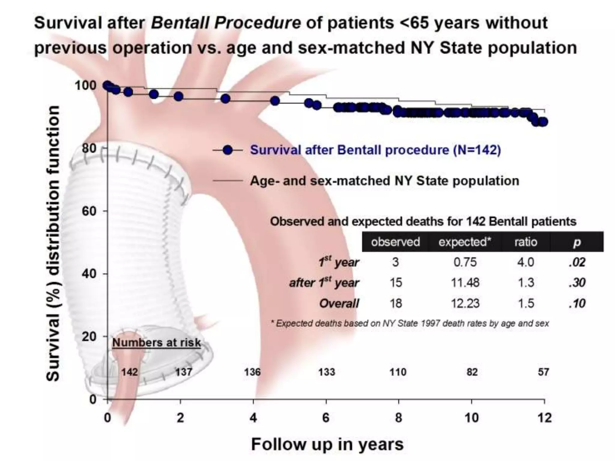 Revisiting bentall procedure | PPTX