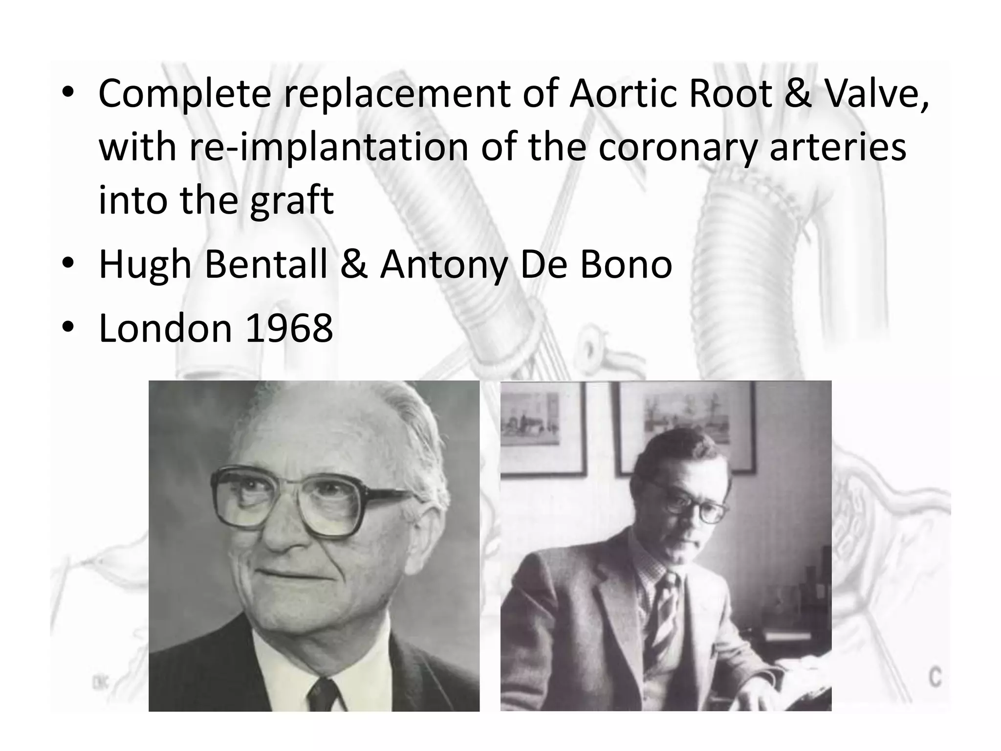 Revisiting bentall procedure | PPTX