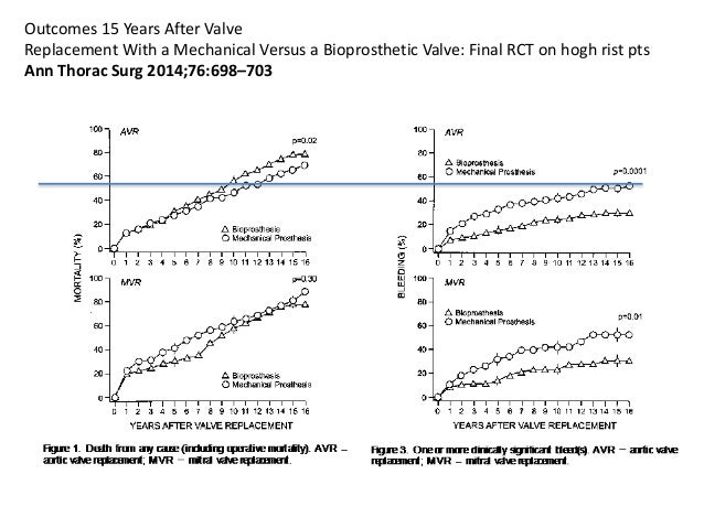 Revisiting bentall procedure