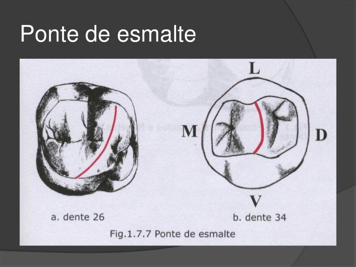 Revisão anatômica dental