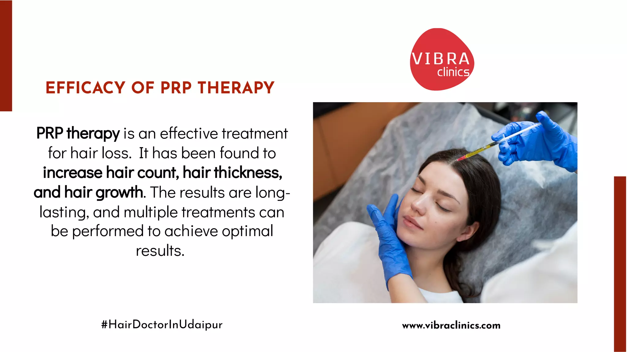 Hair Loss Treatment With PRP Therapy : Benefits and Process | PDF