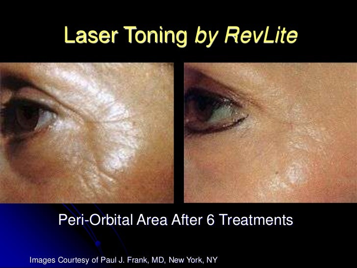 Dr. Darm Revlite Technical Overview | PPTX | Skin and Dermatology ...