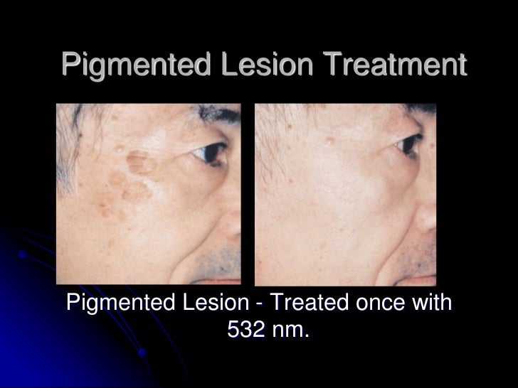 Dr. Darm Revlite Technical Overview | PPTX | Skin and Dermatology ...