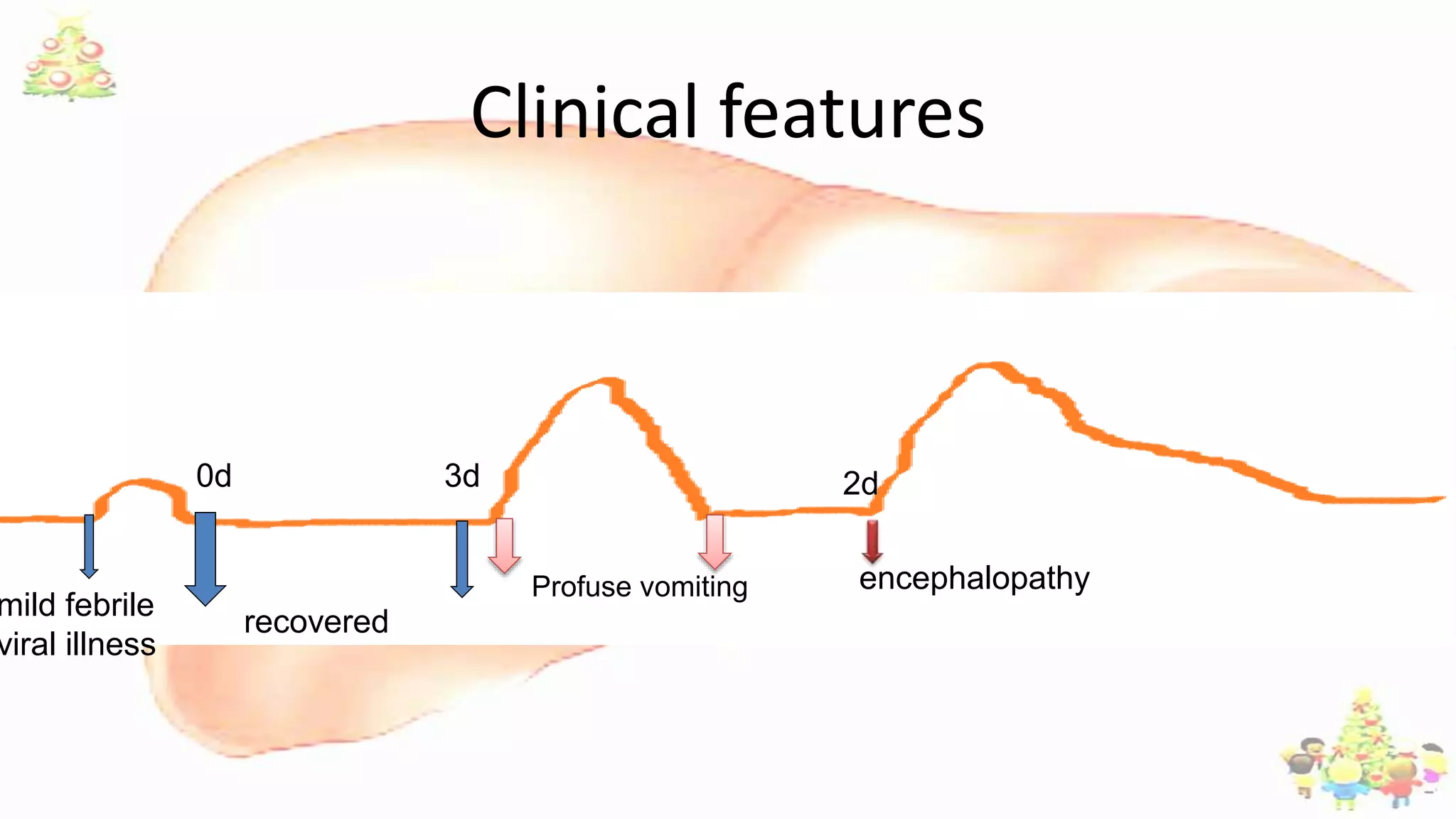 Reye’s syndrome | PPTX