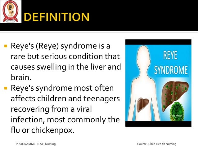 REYES SYNDROME.pptx