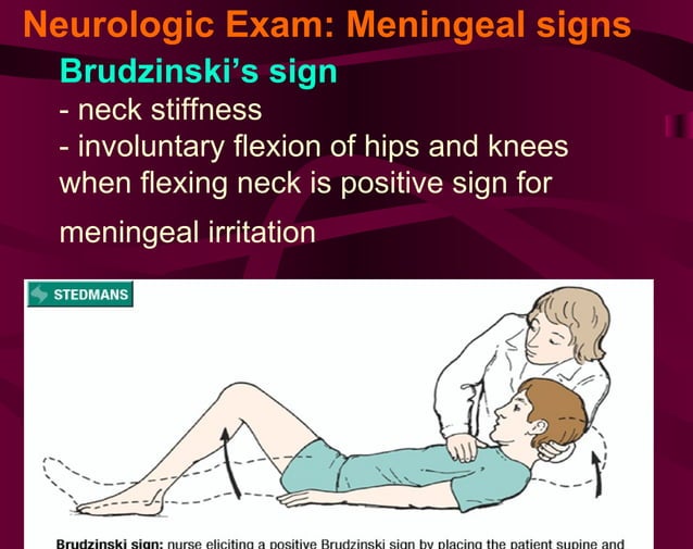 Neuro Assessment | PPT