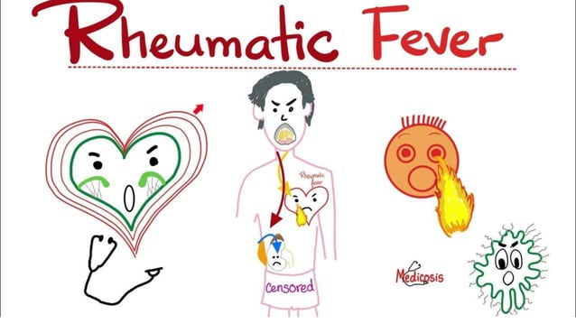 RHEUMATIC FEVER ,Introduction,Etiology,Clinical manifestations ...