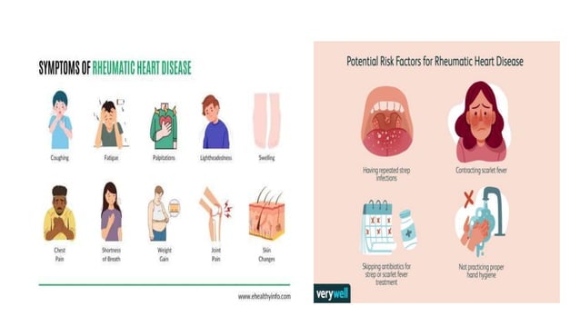 RHEUMATIC FEVER ,Introduction,Etiology,Clinical manifestations ...