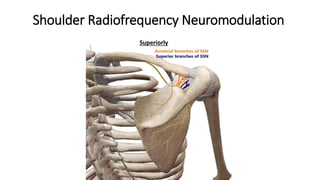 RFA targets conventional,pulsed.pptx