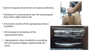 RFA targets conventional,pulsed.pptx
