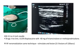 RFA targets conventional,pulsed.pptx