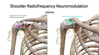 RFA targets conventional,pulsed.pptx